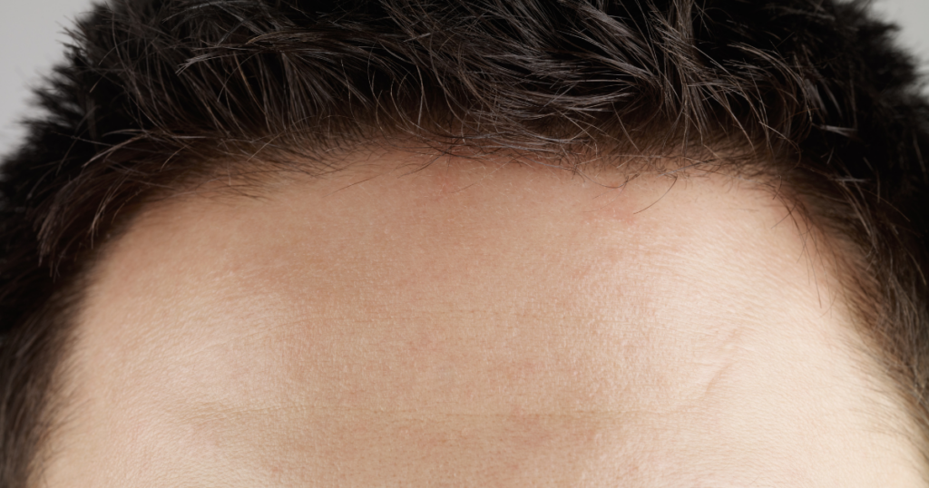 Top 10 Flattering Hairstyles for Males with Big Foreheads